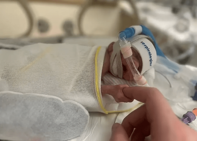 Bebê que nasceu pesando apenas 450 gramas vai para casa após 181 dias ...